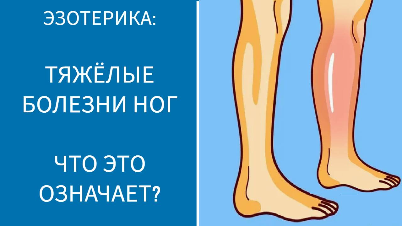 ЭЗОТЕРИКА: ТЯЖЁЛЫЕ БОЛЕЗНИ НОГ. ЧТО ЭТО ОЗНАЧАЕТ?