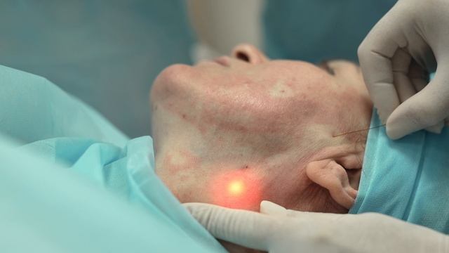 Endolift в Beauty clinic