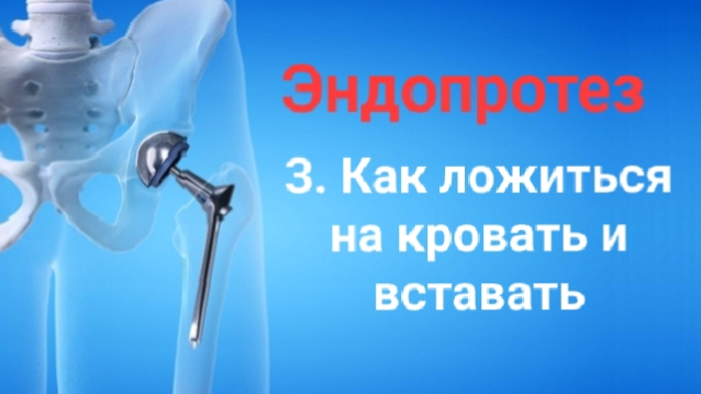 0.3 эндопротез тбс, лечь и сесть