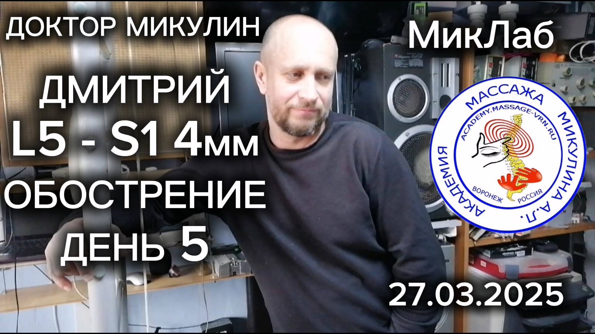 Дмитрий. L5-S1 4 мм. Обострение. День 5. Доктор Микулин. 27.03.2025. МикЛаб