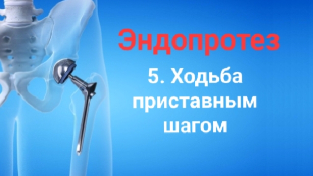 0.5 эндопротез тбс, ходьба приставным шагом