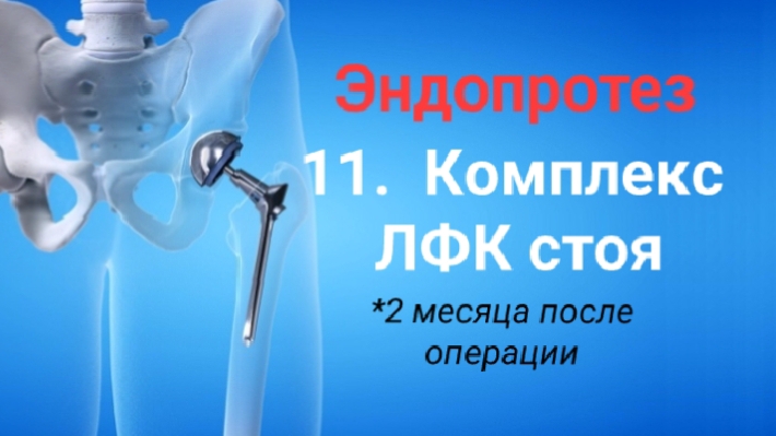 0.11 эндопротез тбс, ЛФК стоя
