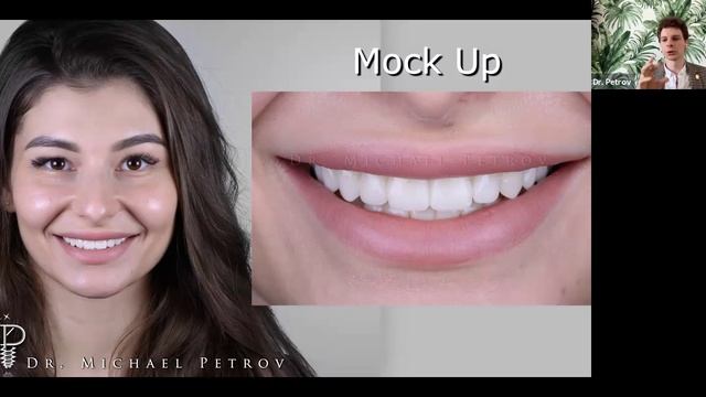 Product Training. DMG LUXATEMP