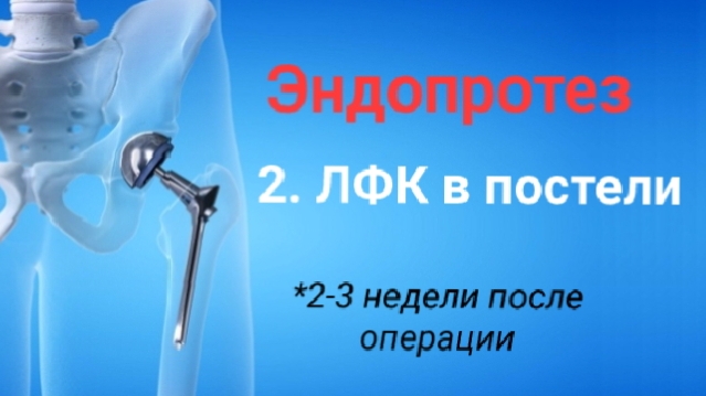 0.2 эндопротезирование тбс, ЛФК в постели