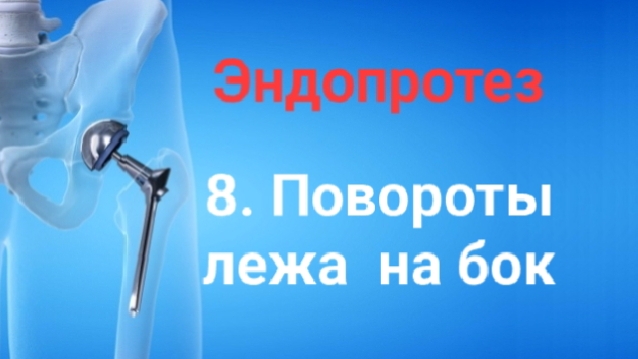 0.8 эндопротез, повороты на бок