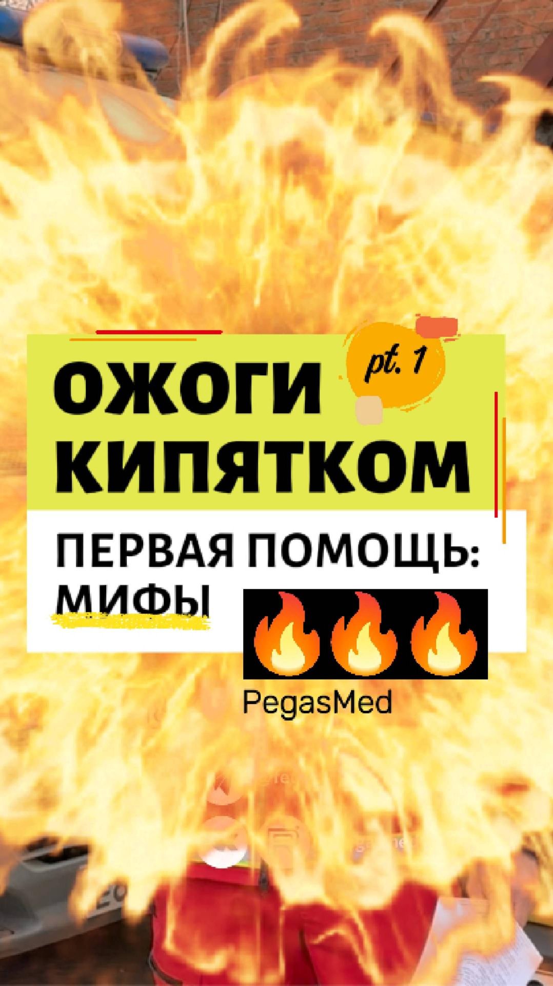 ОЖОГ КИПЯТКОМ 🔥 первая помощь, мифы