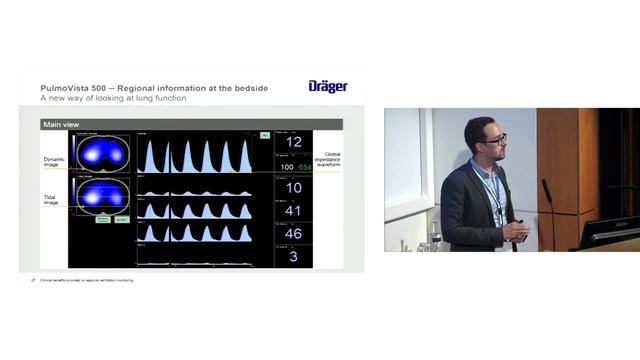 EIT monitoring  AVS 2018