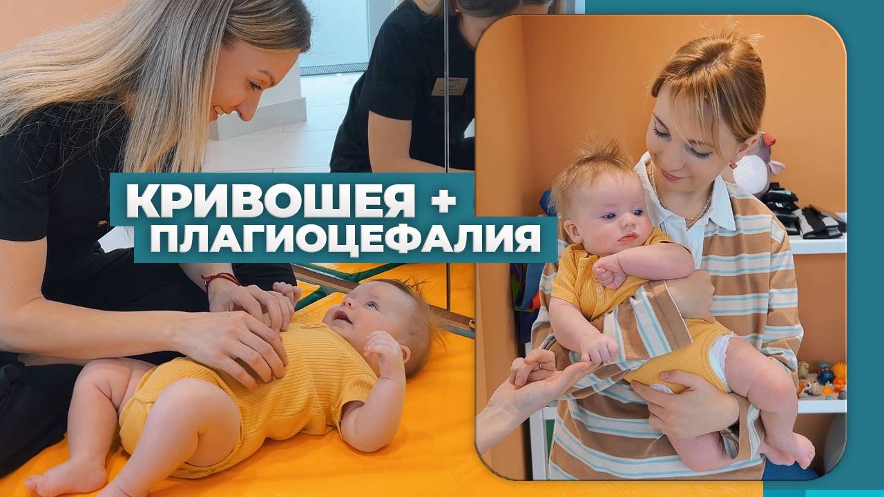 Кривошея и плагиоцефалия: ждать или действовать?