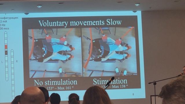 Конференция им. Шабалова, день 2. Выступление Никиты Козулина