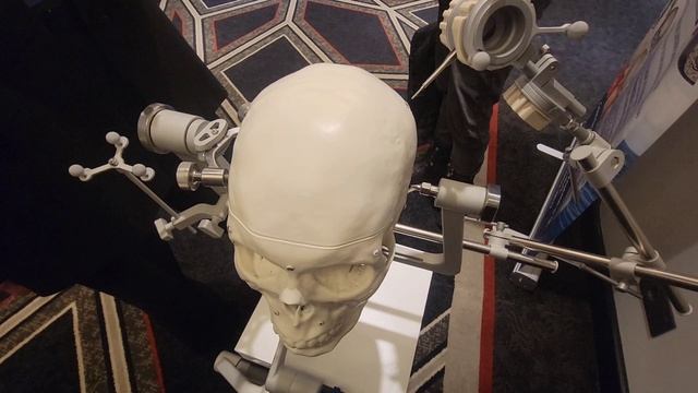 Конференция им. Шабалова 27032025. Стереотаксис