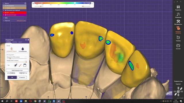 Моделирование анатомии фронтальной группы зубов