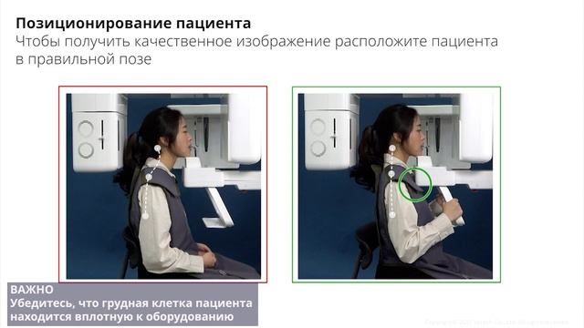 Позиционирование пациента на компьютерном томографе Vatech А9