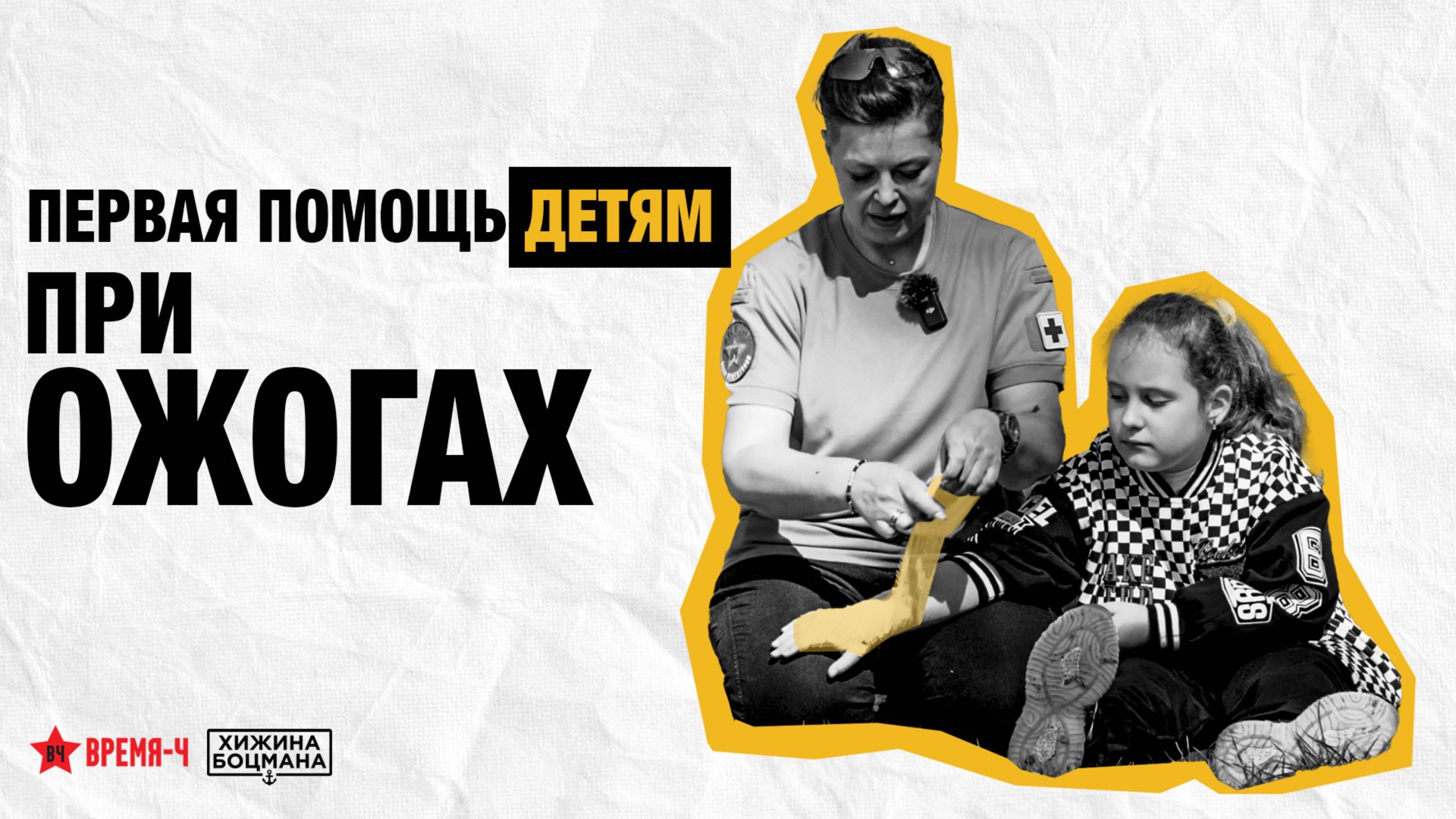 Ожоги у ребенка. Как оказать первую помощь. (ТЕМА №2)