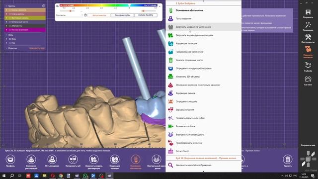 Анатомическая коронка с ручным позиционированием винтового канала