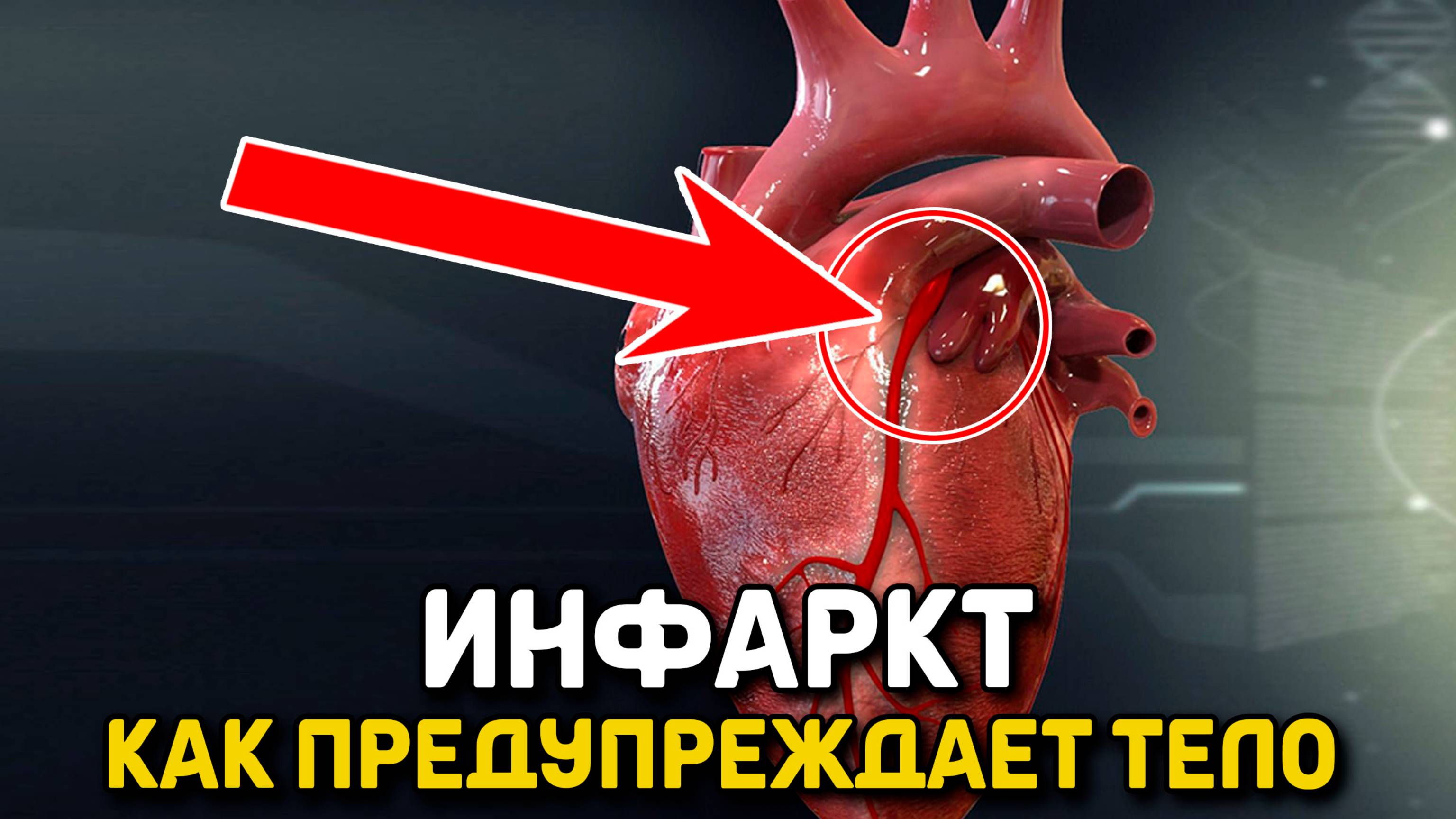 ИНФАРКТ! 5 РАННИХ ПРИЗНАКОВ И СИМПТОМОВ  - Народная медицина - Как лечить