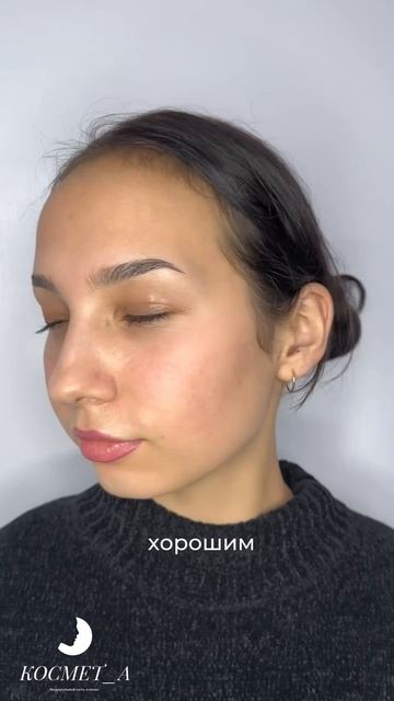 Нет прыщам, нет закрытым комедонам