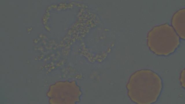 20201027-182959-ММ3320М, Раздавленный нейтрофил, дегрануляция