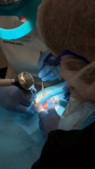 Профессиональная гигиена полости рта с использованием искусственного интеллекта Diana.