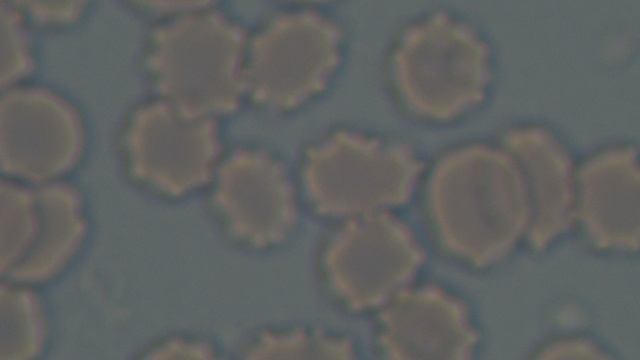 20201028-173735-ММ3320М,Микромед 3 в 3-20М + 3,1Мп  камера 50к-с+1х-линзовый