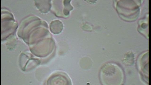 МНК микроскопия нативной крови, пойкилоцитоз, гемосканирование, + хищные грибы, колонии микоплазмы