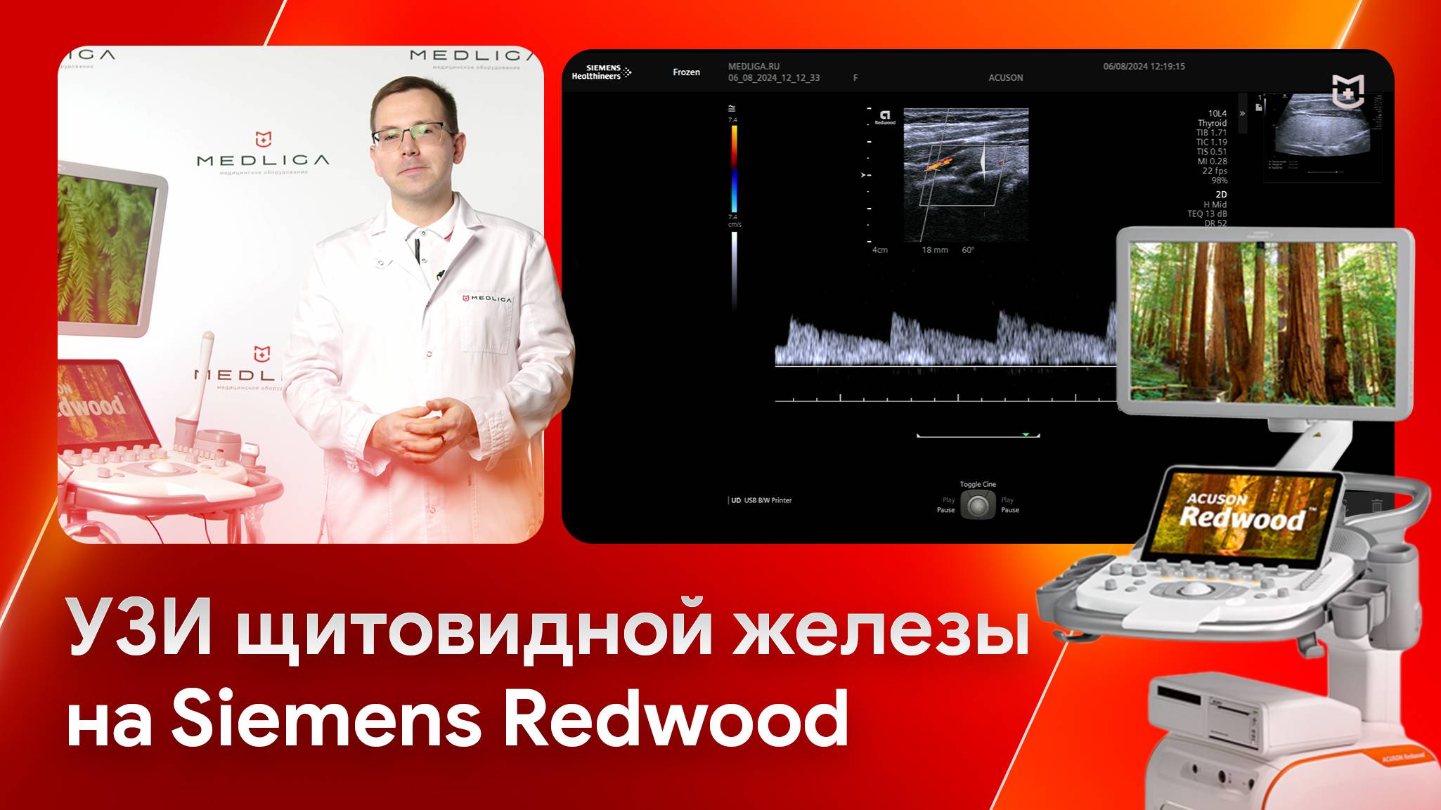 Мастер-класс по УЗИ щитовидной железы на Siemens Acuson Redwood