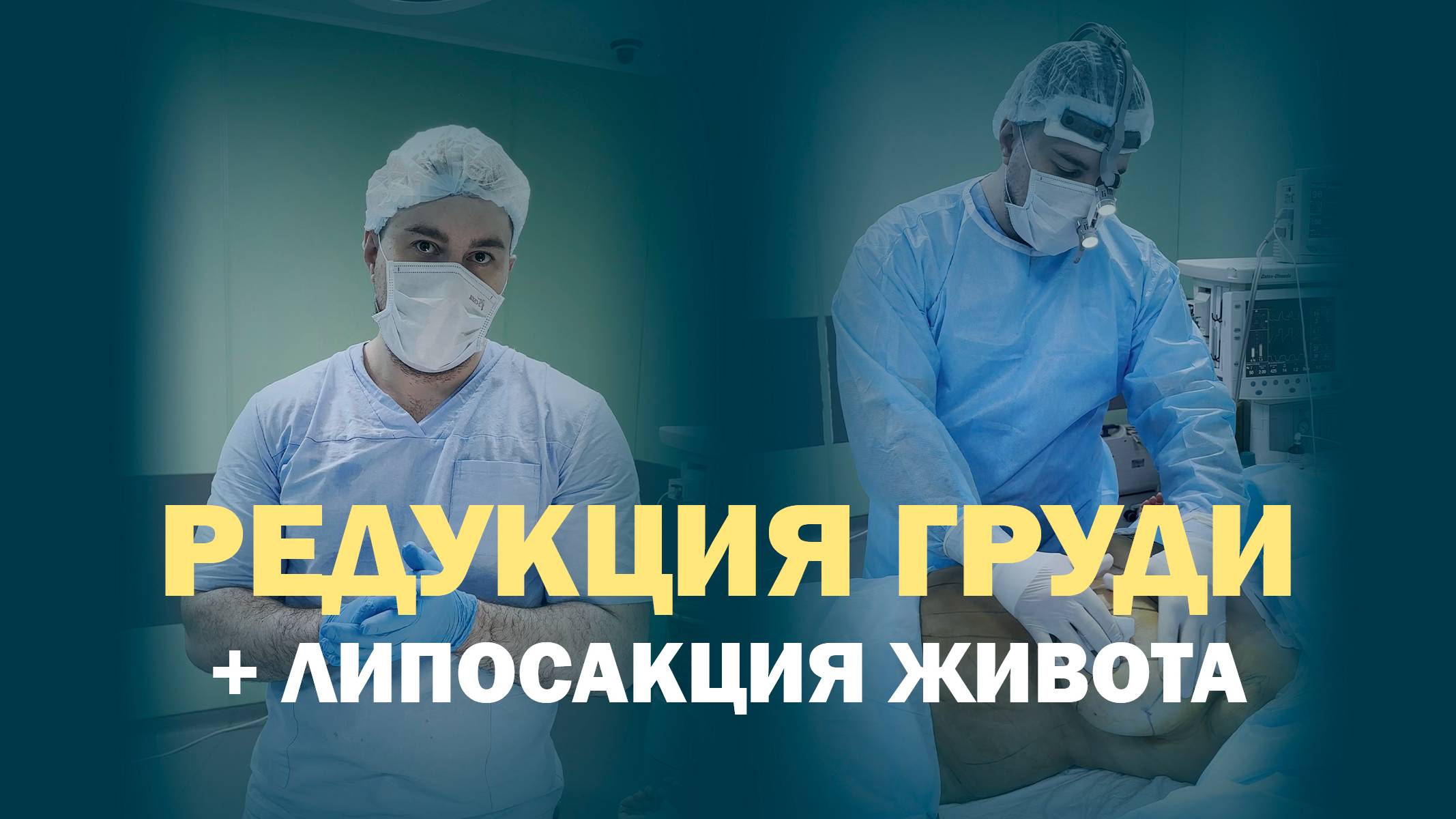 Редукция груди и липосакция живота: новый силуэт