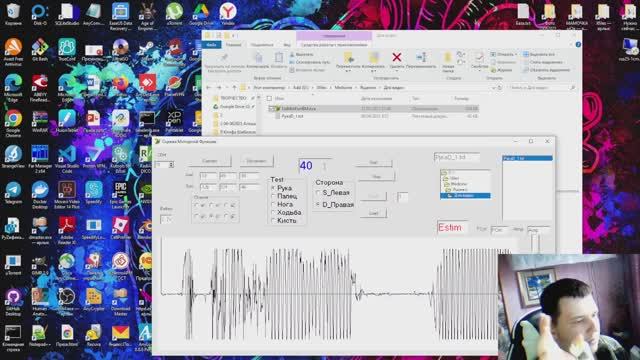 Настройка и использование программы Бурденко для учета динамики движений конечностей пациентов