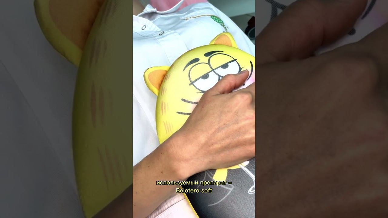 Belotero Soft в технике бланширования