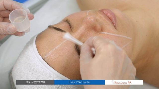 Easy TCA Classic / Starter