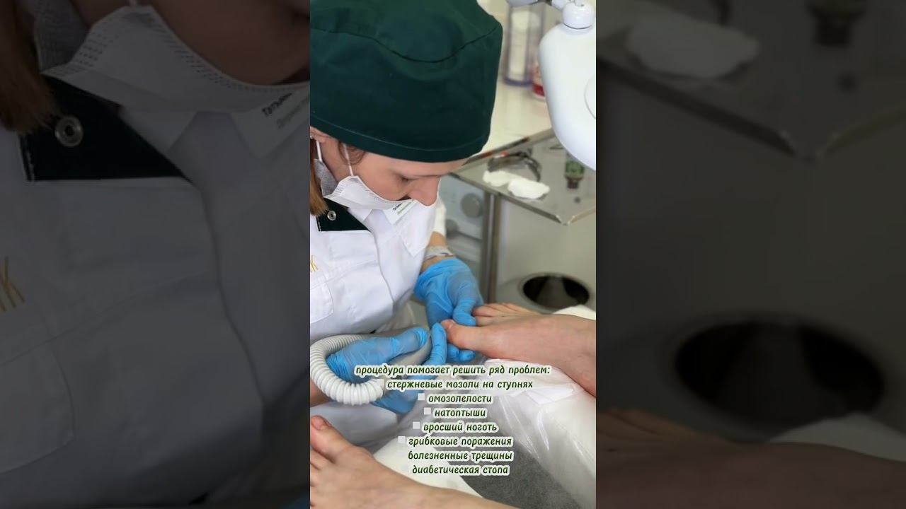 Медицинский педикюр