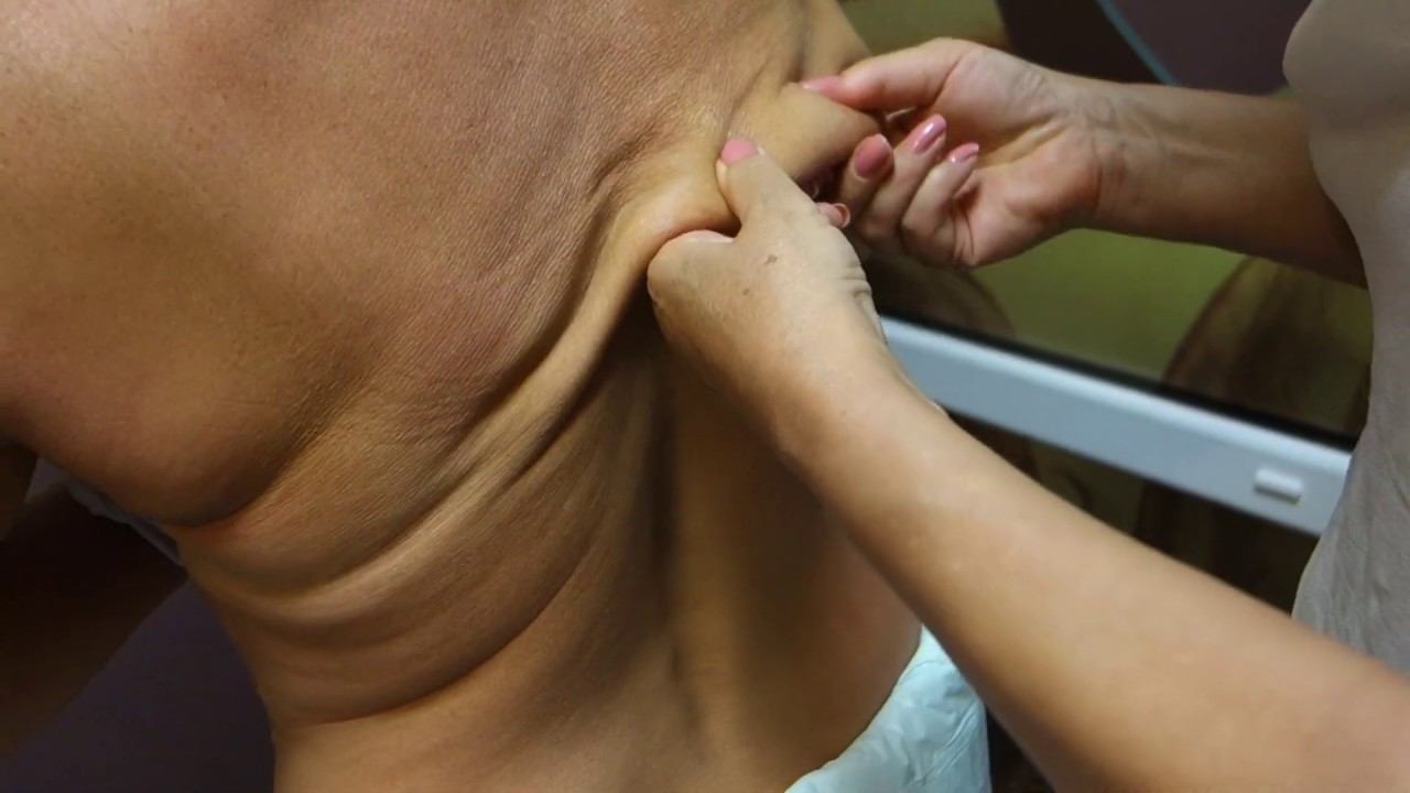 Как убрать складки на спине и боках, ручные методы Наталия Осьминина