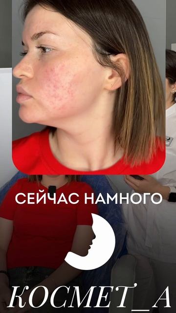 Комплексы не должны становиться вашим спутником по жизни