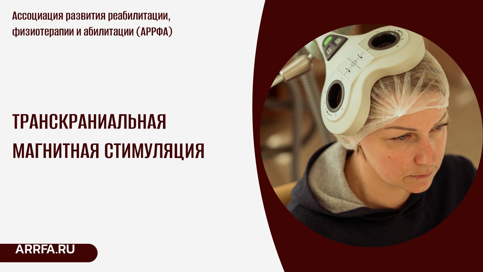 Транскраниальная магнитная стимуляция