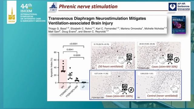Ventilator-associated brain injury (VABI)  Martin Dres  ISICEM-44 (2025)