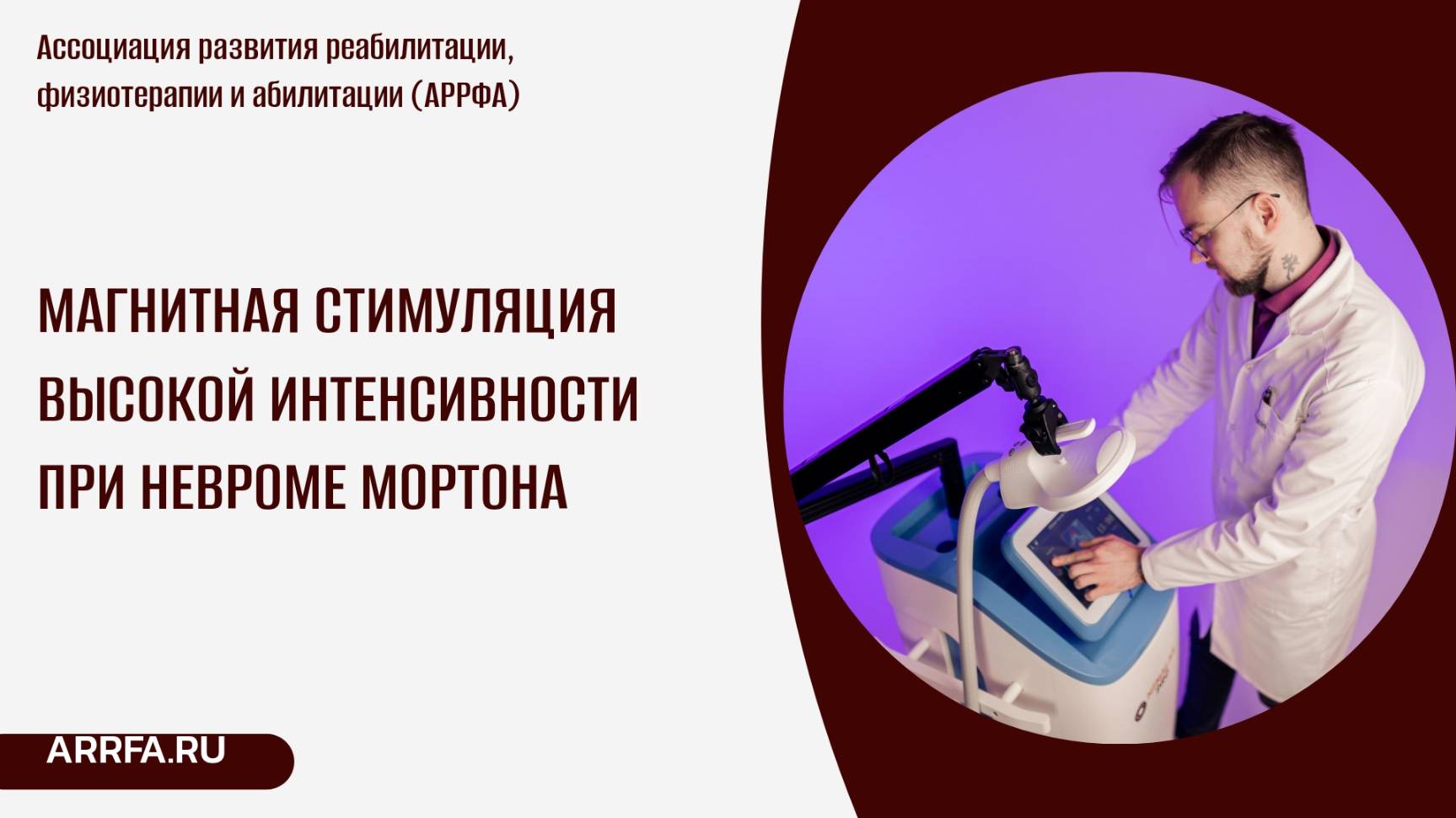 Магнитная стимуляция высокой интенсивности при невроме Мортона и метатарзалгии