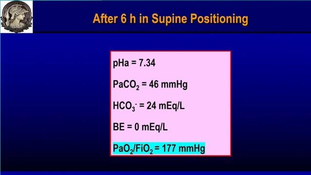 Personalized mechanical ventilation In ARDS Patricia Rocco  ISICEM-44 (2025)