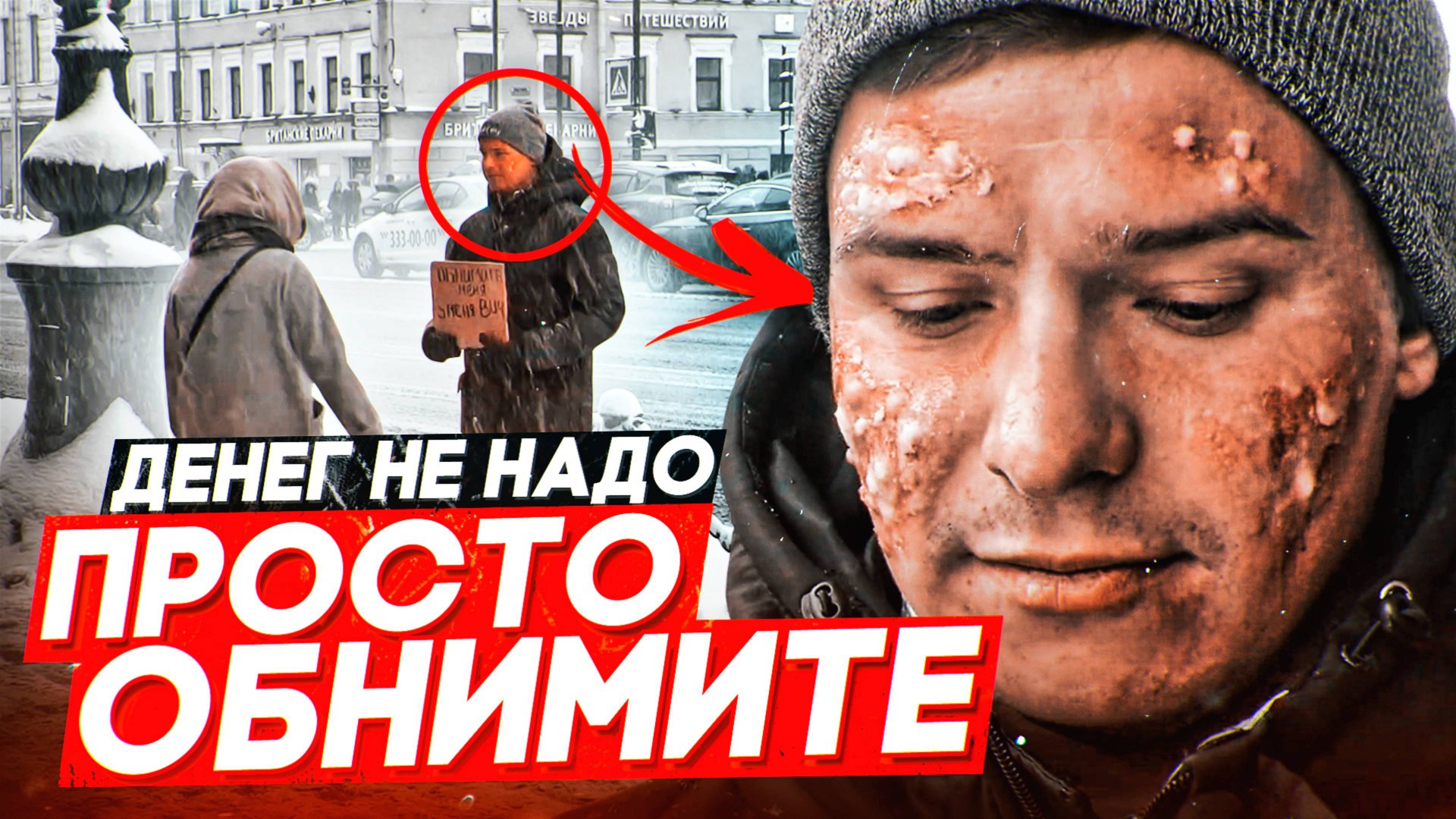 РЕАКЦИЯ прохожих на БОЛЬНОГО / Обними меня, у меня ВИЧ соц эксперимент