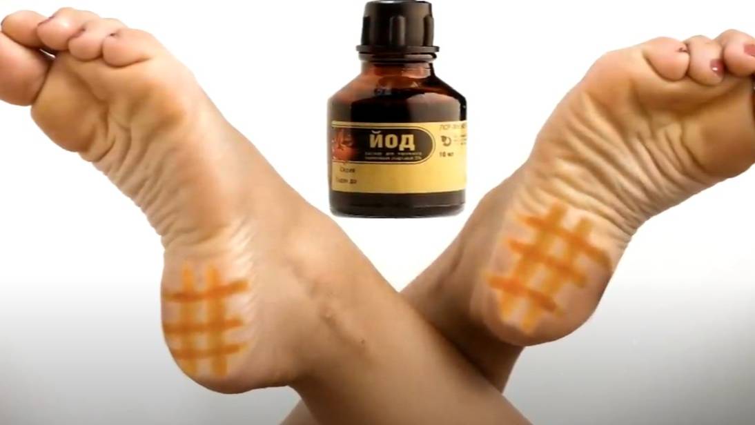 ЗАЧЕМ НА НОЧЬ МАЖУТ ПЯТКИ ЙОДОМ