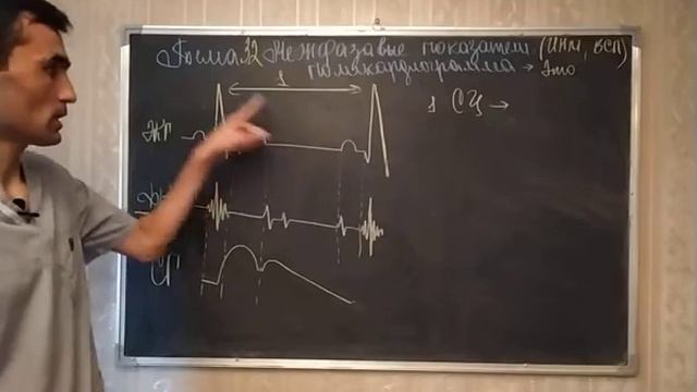 32 МЕФАЗОВЫЕ ПОКАЗАТЕЛИ ПОЛИ КАРДИОГРАММЫ