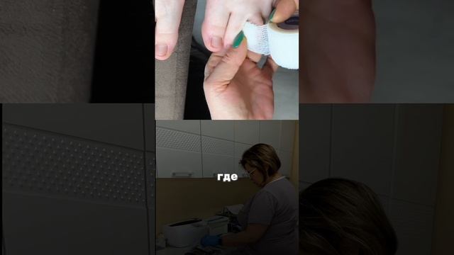 Как сделать разгрузку межпальцевой мозоли подручными материалами.