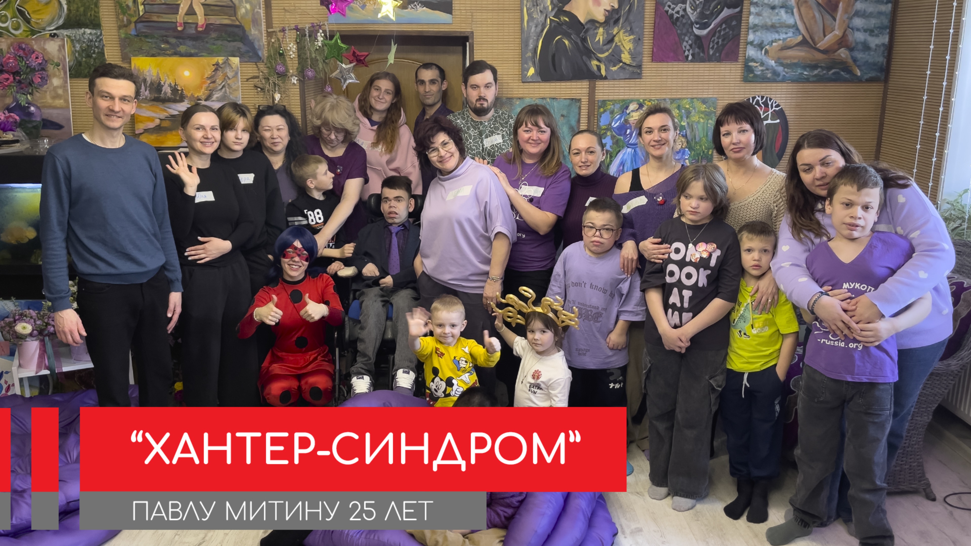 Пациенту с мукополисахаридозом исполнилось 25 лет