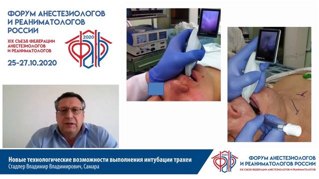 Новые технологии интубации трахеии Стадлер В.В ФАРР 2020