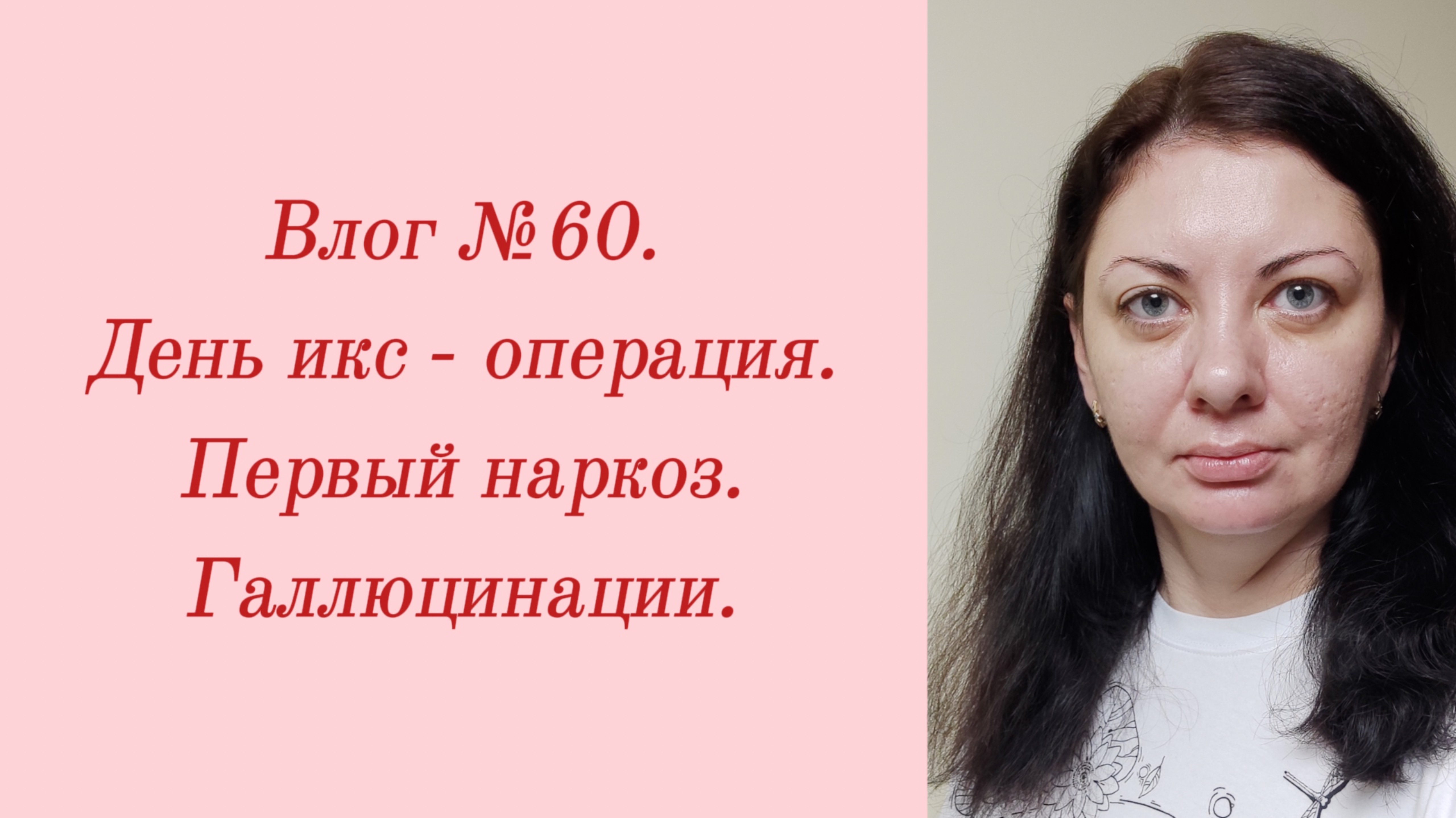 Влог №60. День "икс" - операция/ Первый наркоз/ Галлюцинации. 23-24 октября 2024.