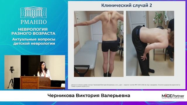 Черникова  В.В. «Маски прогрессирующей миодистрофии Дюшенна. Современные возможности диагностики »