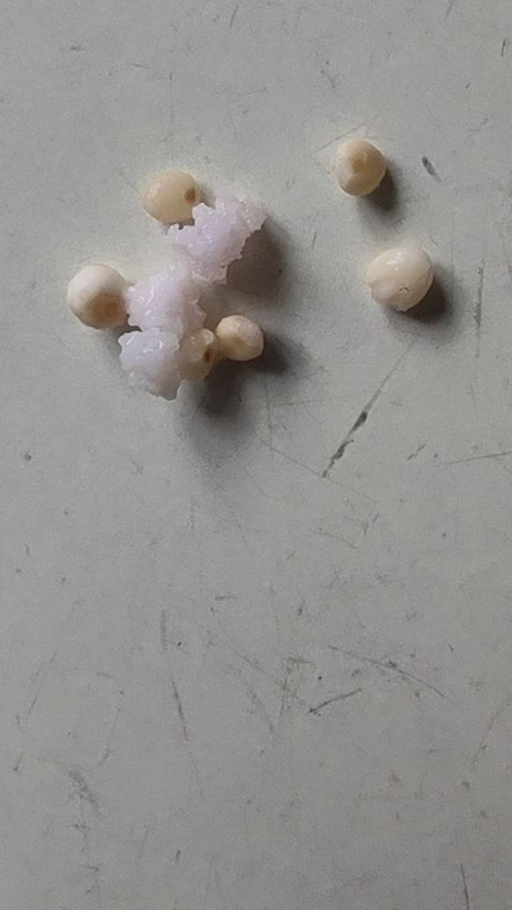 Кефирный грибок трансформировался в пшено