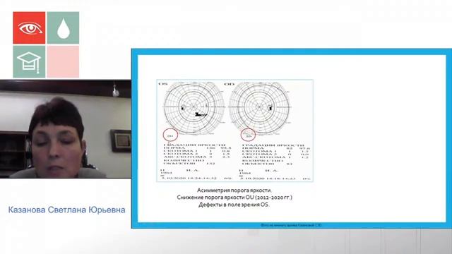 Подозрение на глаукому. Нюансы диагностики