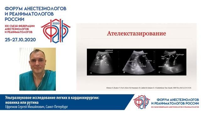 УЗИ легких в кардиохирургии Ефремов СМ  ФАРР 2020