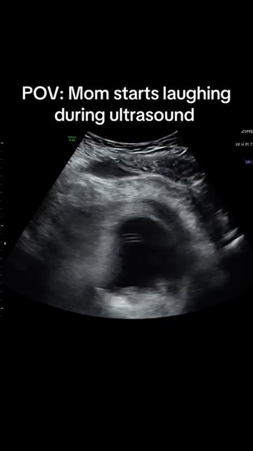 Смех матери на узи