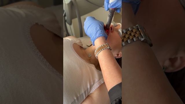 Вебинар 11.04.25. Протоколы Fotona "лицо под ключ" для пациентов 40 лет