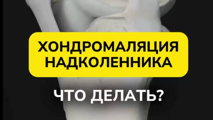 ХОНДРОМАЛЯЦИЯ НАДКОЛЕННИКА: ЧТО ДЕЛАТЬ?